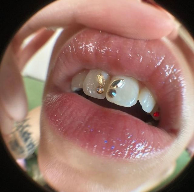 Tooth Gem Starter Kit • MoonRock Gems